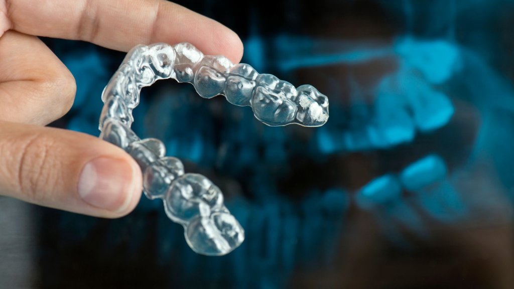 How It Works - SmileInLine - Aligners in line